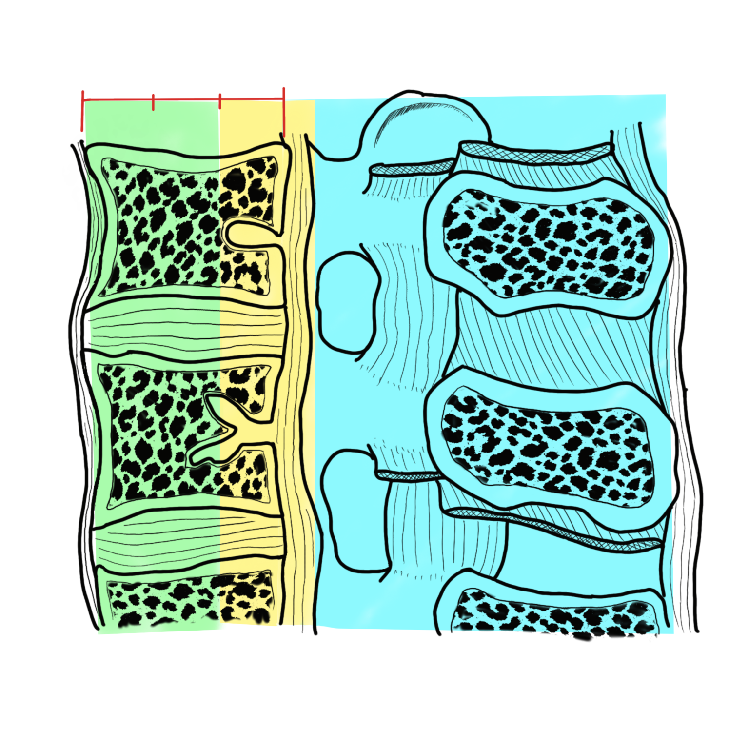 AO 5. 脊椎圧迫骨折 -Denis の “3-column theory”- | 整形外科の情報倉庫